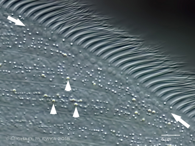 Freshwater and other micro-organisms from Germany: Spirostomum ambiguum ...
