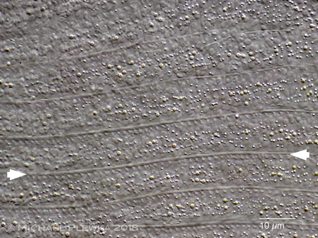 Freshwater and other micro-organisms from Germany: Spirostomum ambiguum ...