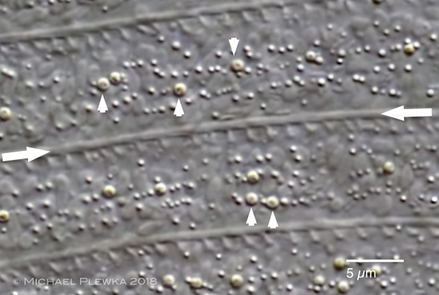 Freshwater and other micro-organisms from Germany: Spirostomum ambiguum ...