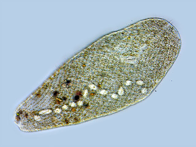 Stefansbachtal Gevelsberg: Leben im Teich: Sumpfwurm (Spirostomum ...