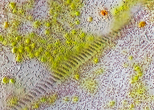 Freshwater and other micro-organisms from Germany: Stentor amethystinus ...