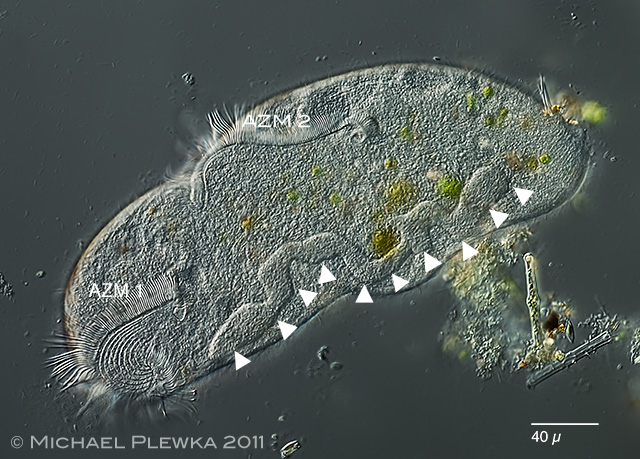 plingfactory: Leben im Teich: Graues Trompetentierchen (Stentor roeseli ...