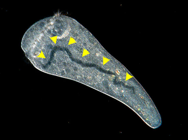 Freshwater and other micro-organisms from Germany: Stentor roeseli ...