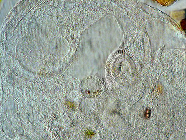 Freshwater and other micro-organisms from Germany: Stentor roeseli ...