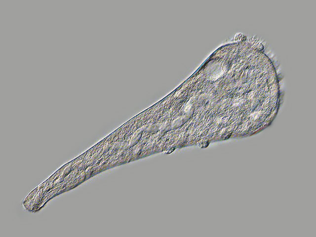 Freshwater and other micro-organisms from Germany: Stentor roeseli ...