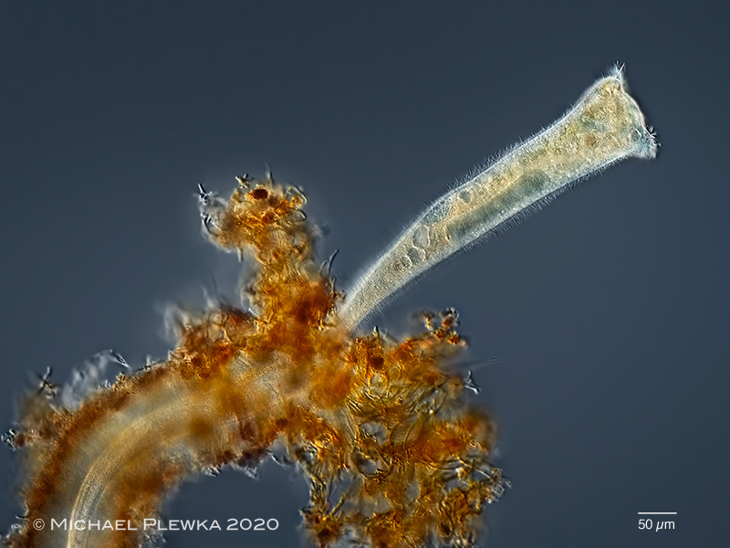 Freshwater and other micro-organisms from Germany: Stentor roeseli ...
