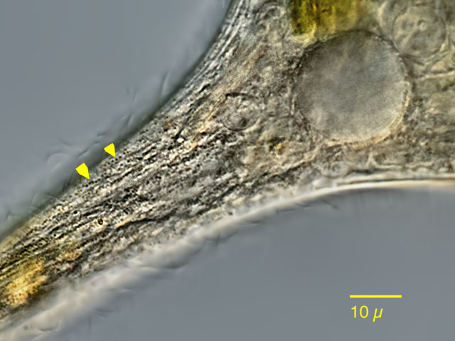 Freshwater and other micro-organisms from Germany: Stentor niger ( Ciliata)