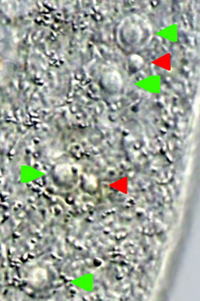 Leben im Teich: Schnabeltierchen (Loxodes magnus)