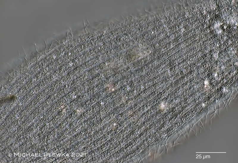 Freshwater and other micro-organisms from Germany: Loxodes magnus ...