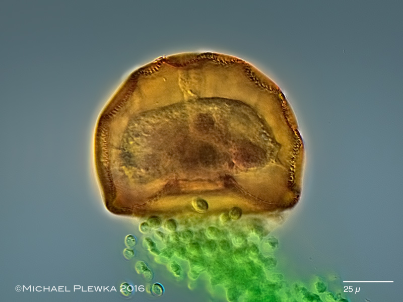 Freshwater and other micro-organisms from Germany:Arcella gibbosa ...