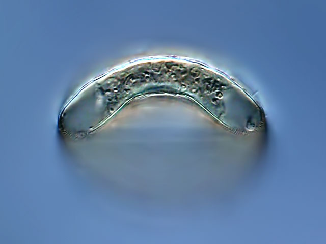 Arcella discoides и Arcella polypora: aspidisca — LiveJournal