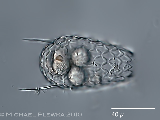 Freshwater and other micro-organisms from Germany: Euglypha ...