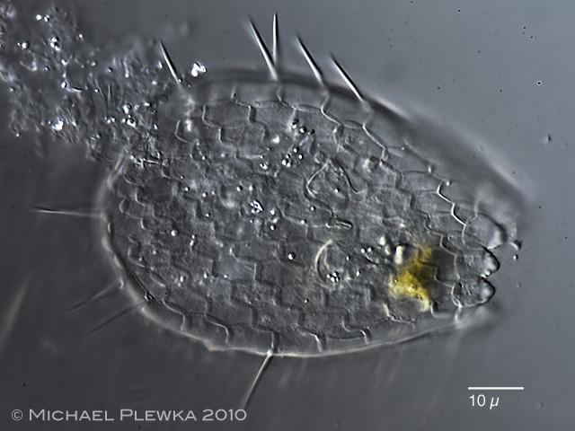 Freshwater and other micro-organisms from Germany: Euglypha filifera ...