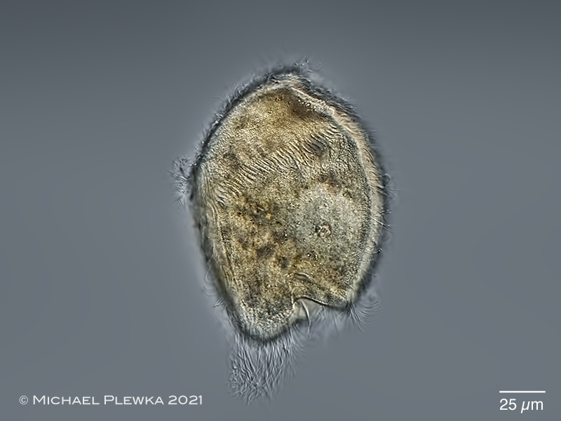 Freshwater and other micro-organisms from Germany: Brachonella spiralis ...