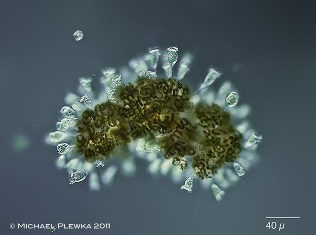 Freshwater and other micro-organisms from Germany: Anabaena spiroides ...