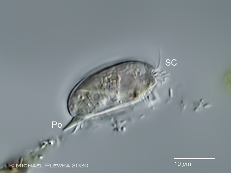 Freshwater and other micro-organisms from Germany: Trochilia minuta ...