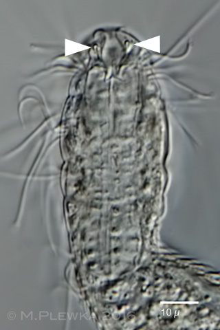 Limnic and other micro-organisms from Germany: Aspidiphorus silvaticus ...