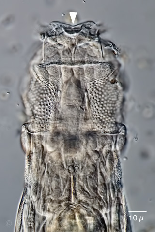 Bdelloid Rotifer Fauna of Germany and Neighbouring Countries: Adineta ...