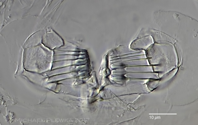 Rotifers of Germany and adjoining countries: Hexarthra mira Hudson 1871 ...