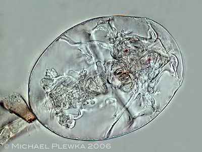 Rotifers of Germany and adjoining countries:Testudinella elliptica ...
