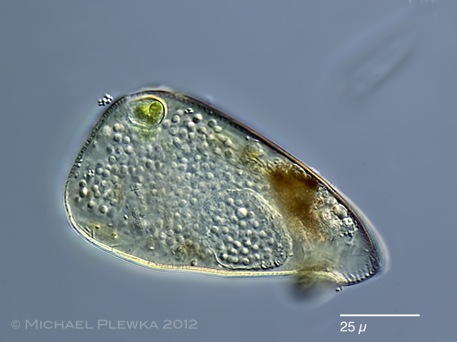 Freshwater and other micro-organisms from Germany: Cyphoderia ampulla ...