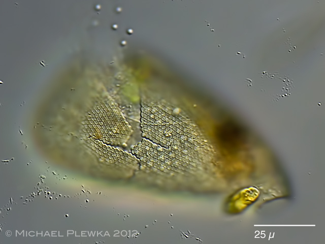 Freshwater and other micro-organisms from Germany: Cyphoderia ampulla ...