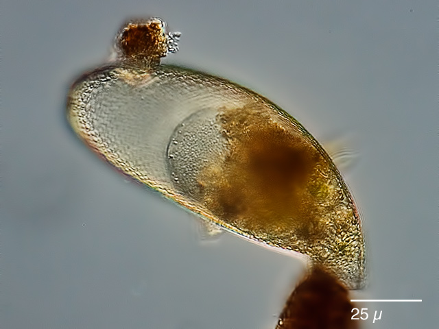 Freshwater and other micro-organisms from Germany: Cyphoderia ampulla ...