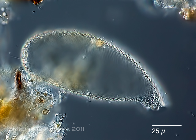 Freshwater and other micro-organisms from Germany: Cyphoderia ampulla ...